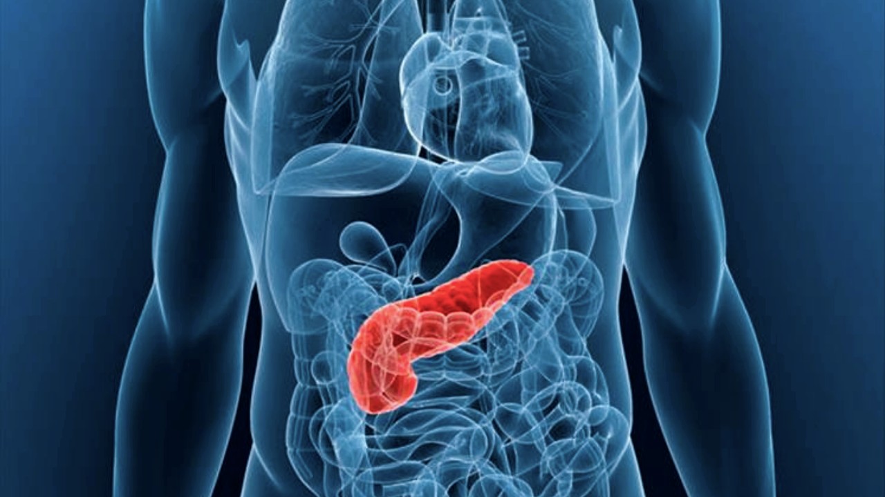 Cáncer de páncreas - Cirujano Oncólogo en Mérida, Yucatán